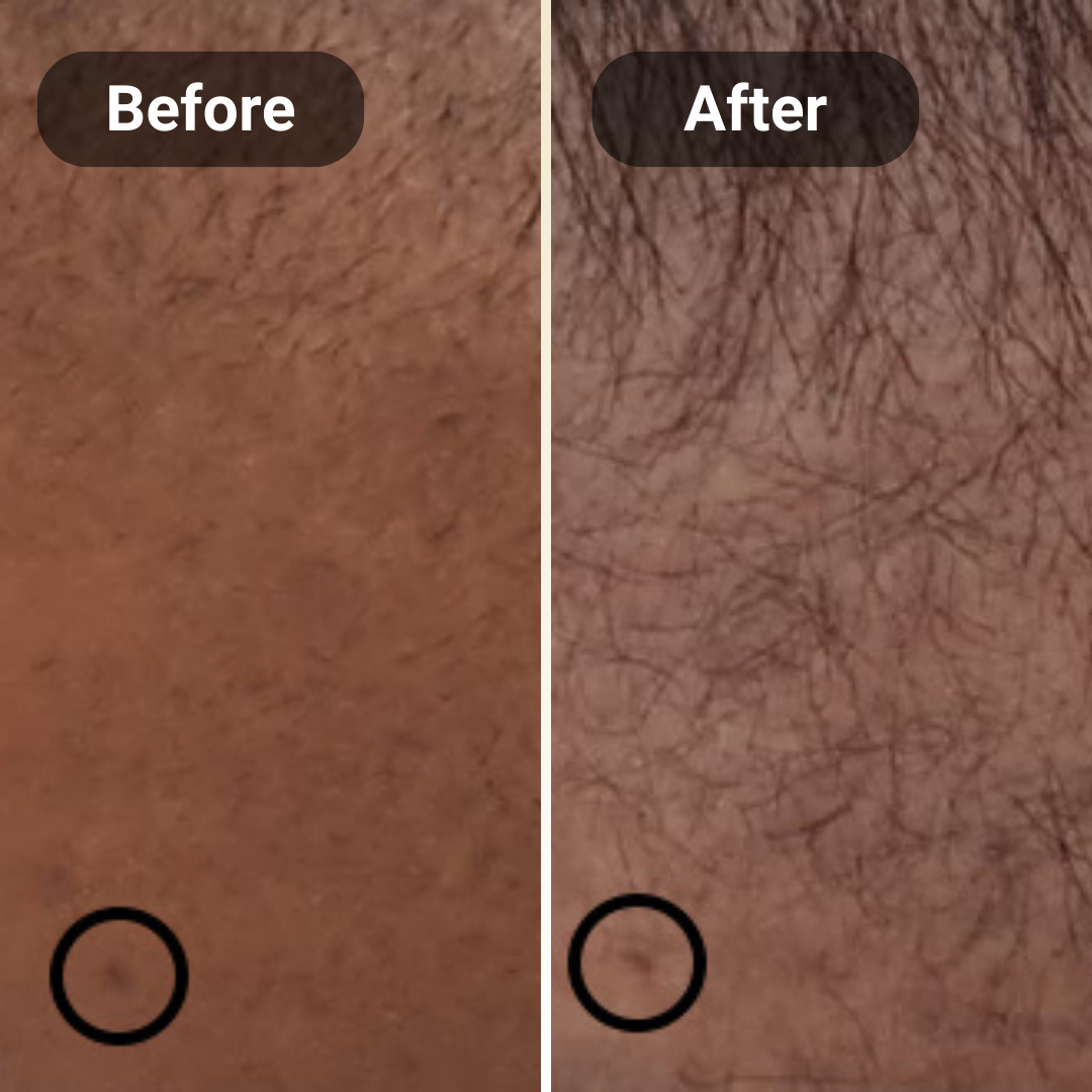 DHT BLOCKER | RedRestore